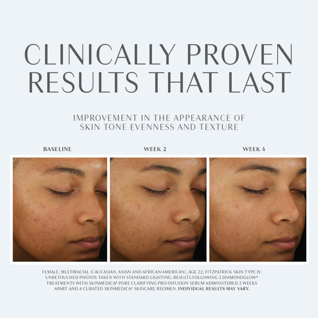Diamond Glow SkinMedica Dermal Infusion Facials - Cadella Aesthetics
